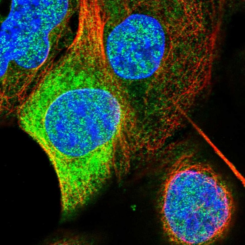 APOL2 Antibody (HPA001078) | Atlas Antibodies
