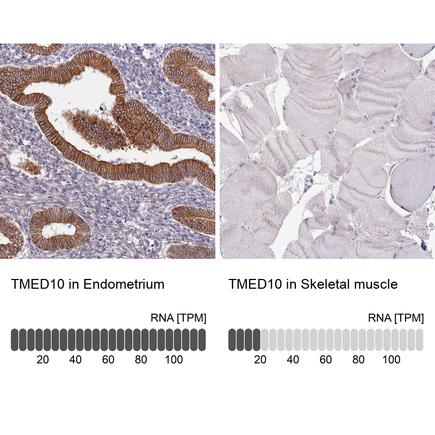 Rabbit Polyclonal Anti-TMED10 Antibody - Buy for research - Atlas ...