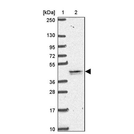 Rabbit Polyclonal Anti-TMEM79 Antibody - Buy for research - Atlas ...