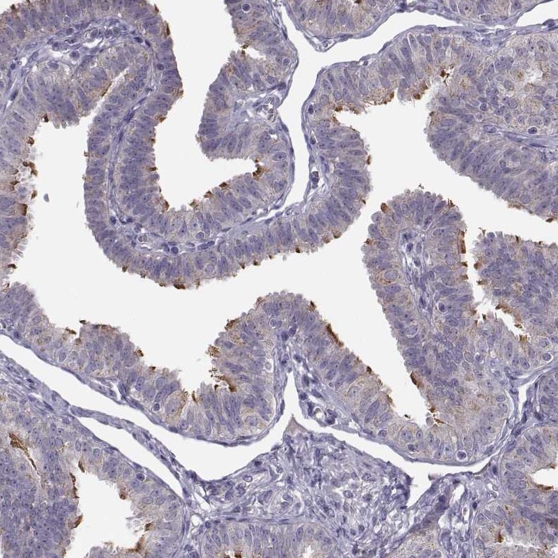 Armadillo Repeat Containing 3 Antibodies | AntibodyResource.com